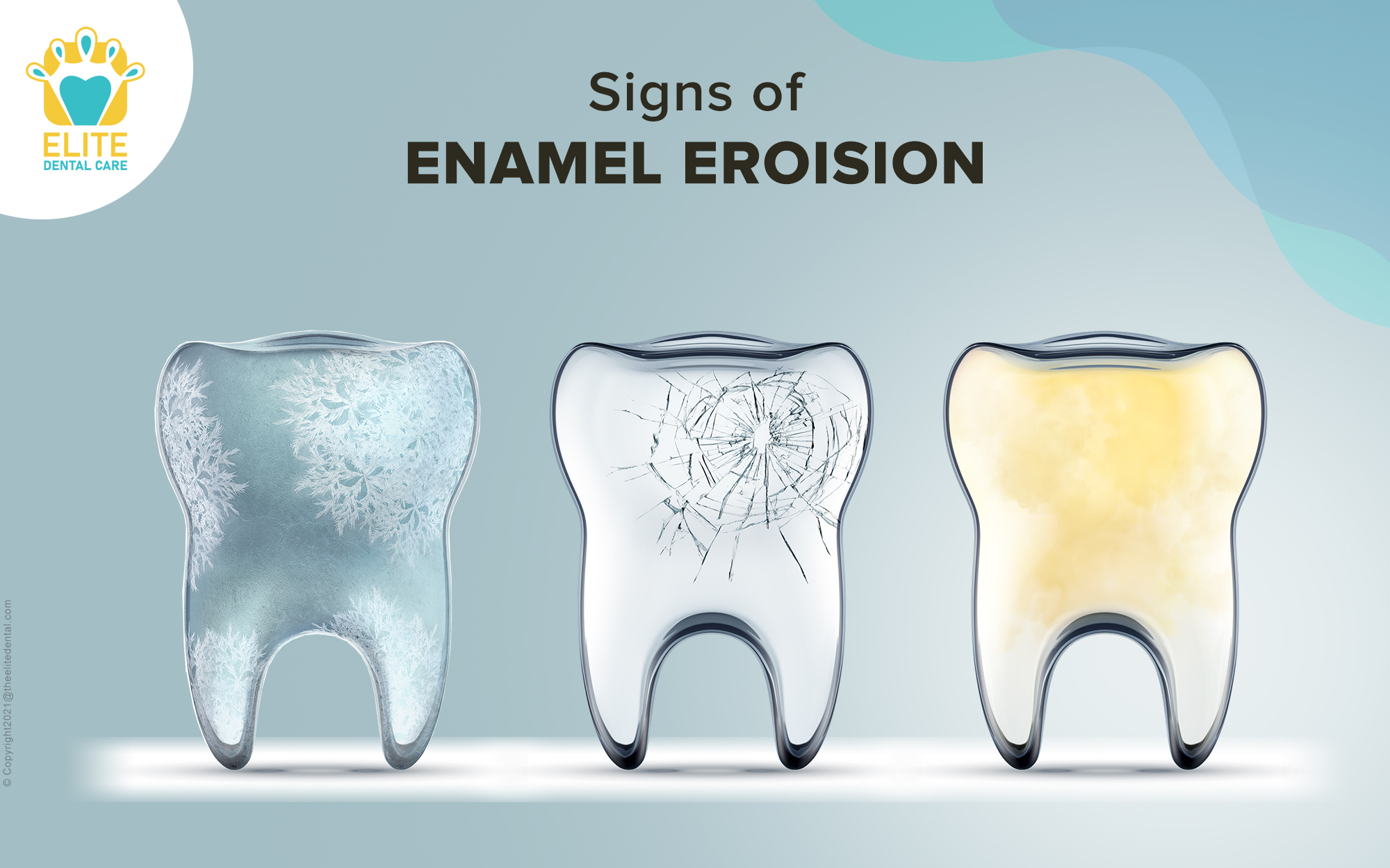 Signs Of Enamel Erosion Elite Dental Care Signs Of Enamel Erosion Elite Dental Care