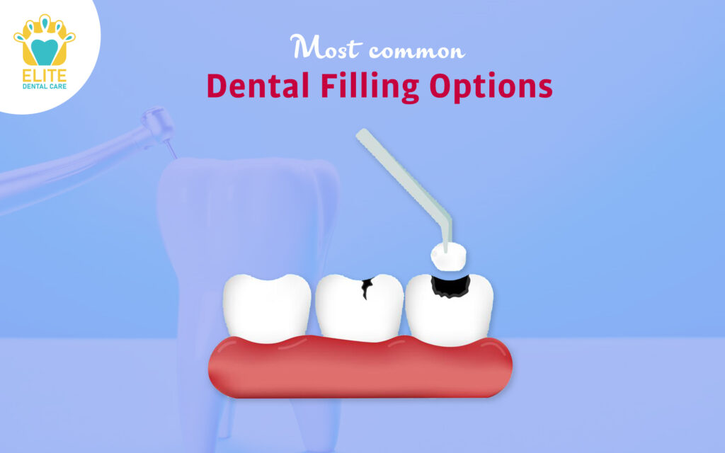 COMMON TYPES OF DENTAL FILLINGS - Elite Dental Care