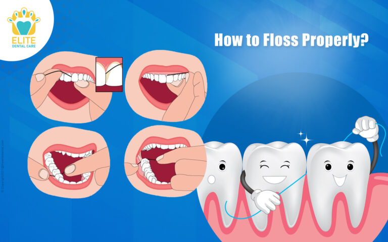 How to Floss Properly? - Elite Dental Care