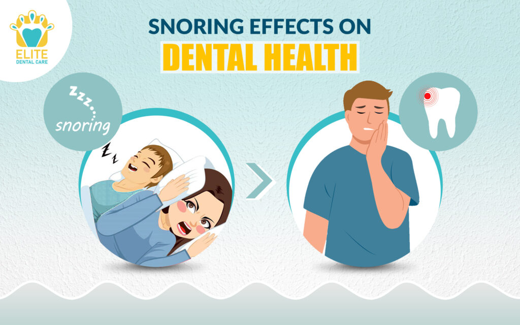 How does Snoring Affect Dental Health? - Elite Dental Care