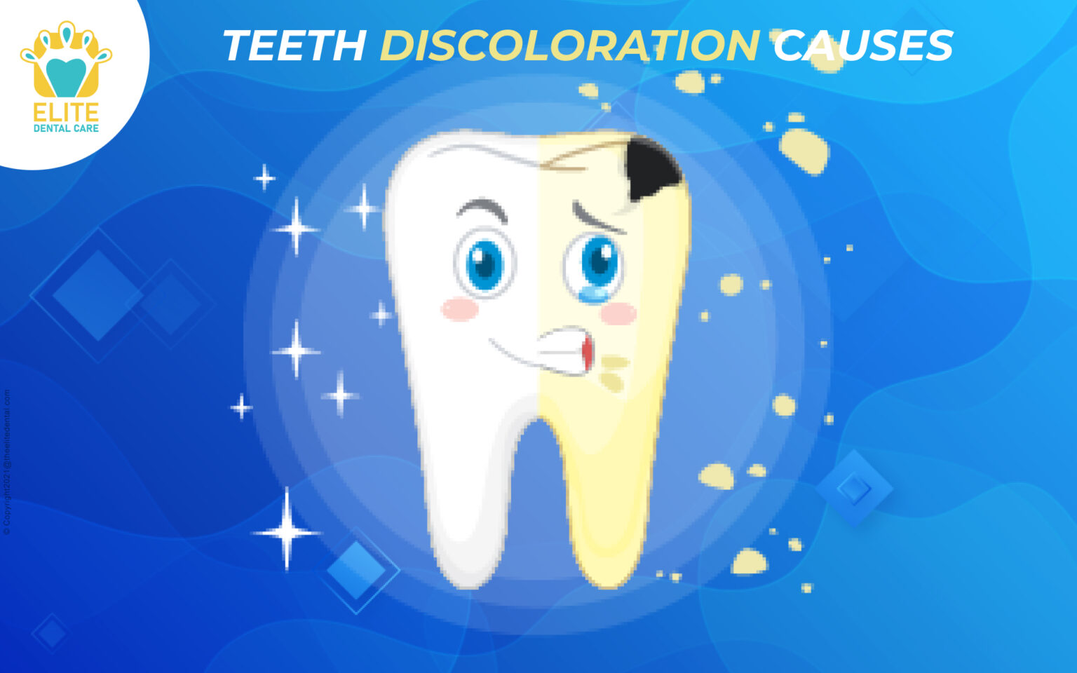 What are the Causes of Teeth Discoloration? - Elite Dental Care