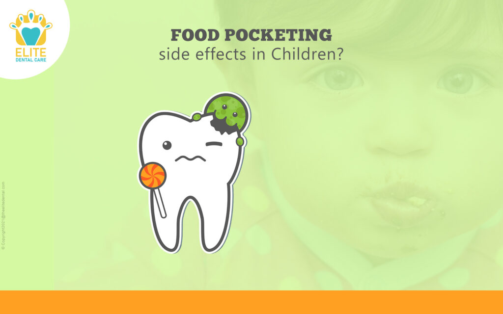 Food pocketing side effects in children - Elite Dental Care