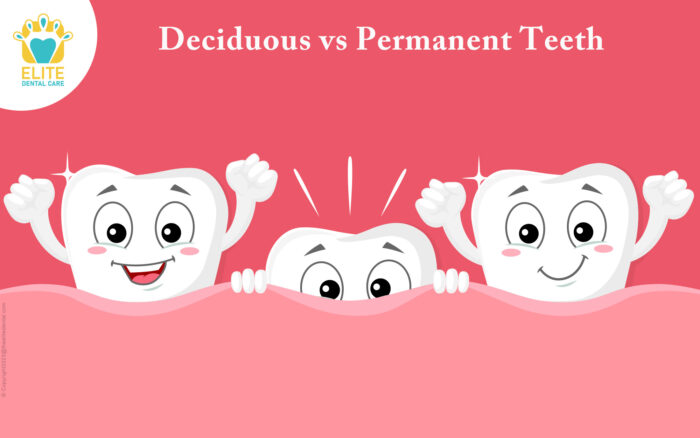 deciduous and permanent teeth differences | Elite Dental Care