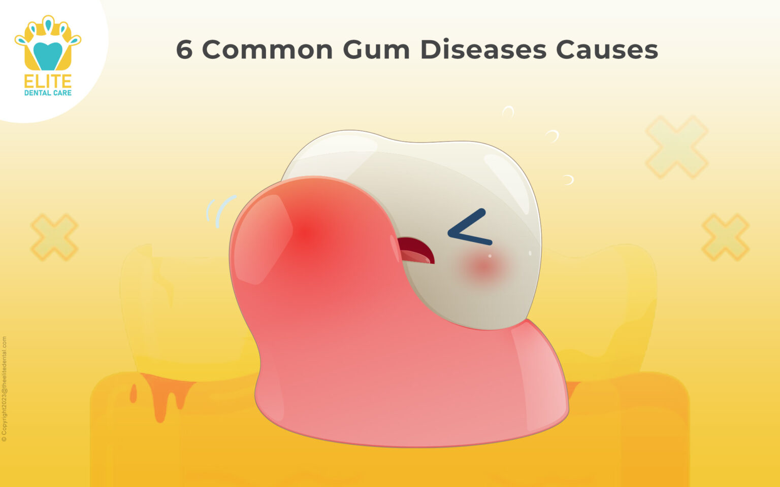 6 Common Gum Diseases Causes - Elite Dental Care