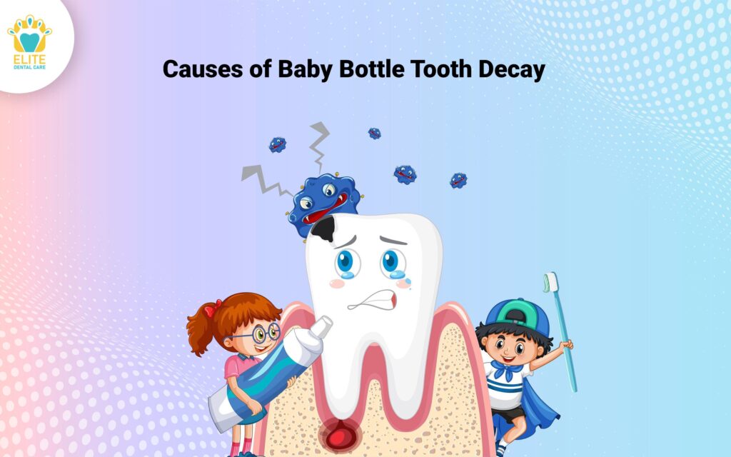 Causes of Baby Bottle Tooth Decay - Elite Dental Care