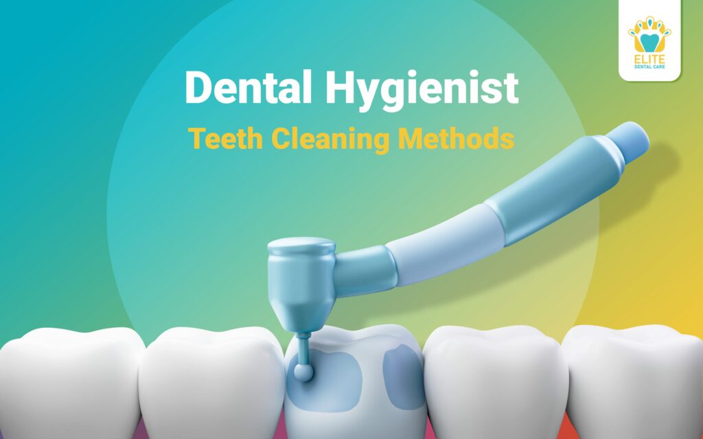 Dental Hygienist Teeth Cleaning Methods - Elite Dental Care