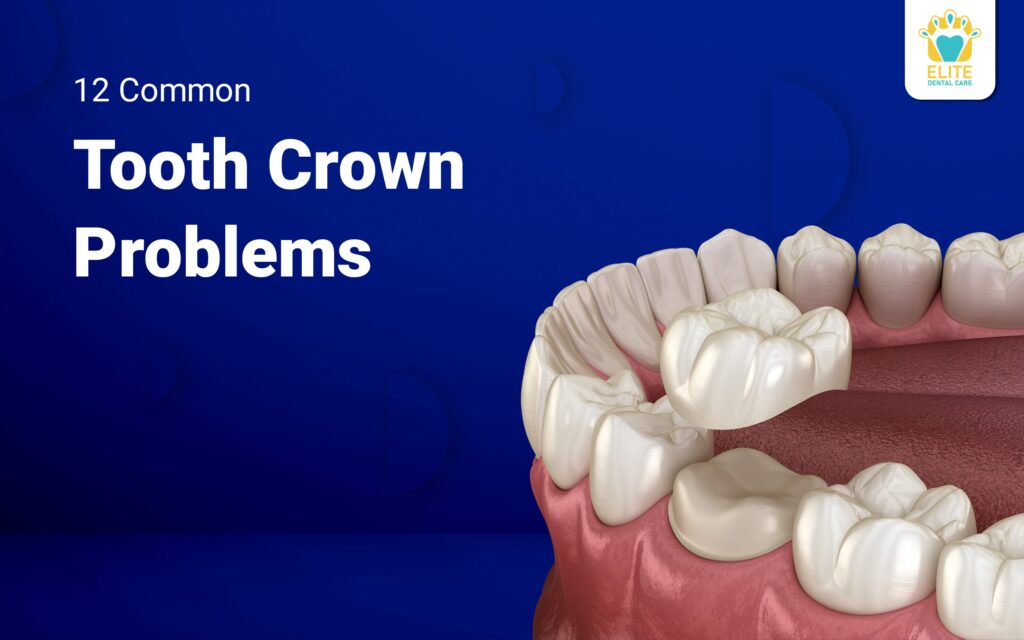 12 Common Tooth Crown Problems - Elite Dental Care