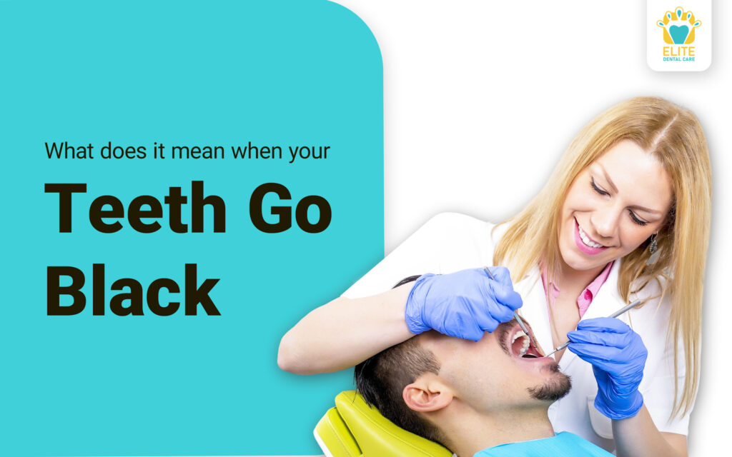 What Causes Black Teeth and How to Address Them? - Elite Dental Care